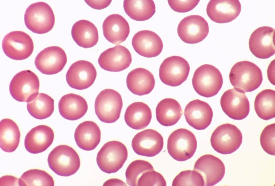 10 Things To Be Sure You Look At When You Read A Blood Smear 