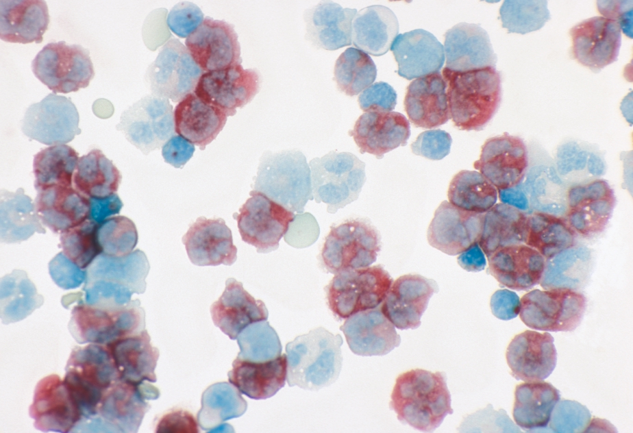 Non-specific esterase stain | Pathology Student