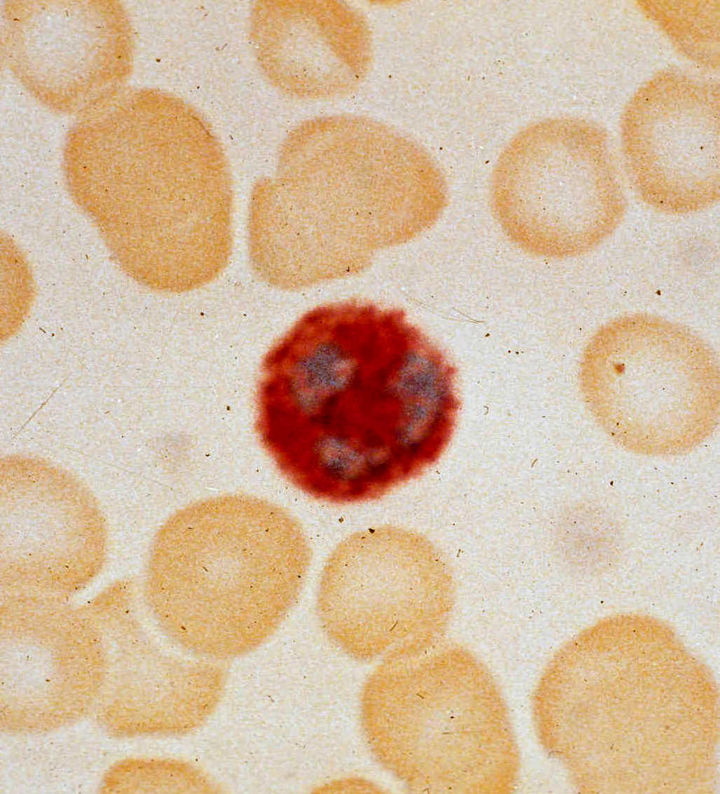 lap +4 | Pathology Student